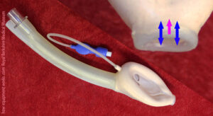 Amazing experimental laryngeal masks : The history of the LMA