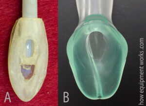 Amazing experimental laryngeal masks : The history of the LMA